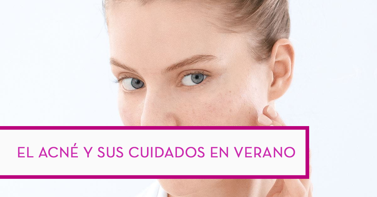 El acné y sus cuidados en verano | Clínica Dra. Paloma Ojel