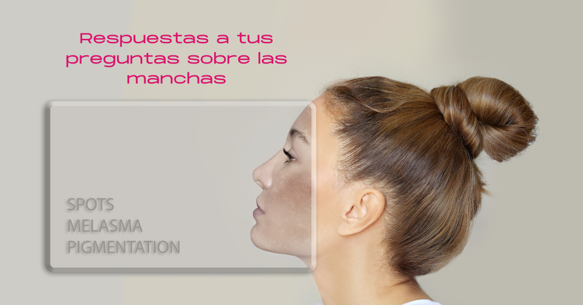 Respuestas a tus preguntas sobre las manchas Respuestas a tus preguntas sobre las manchas